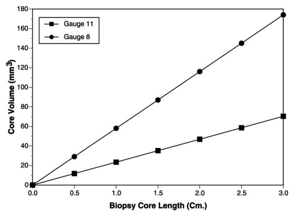 Bone Core Volume Calculation - Aspire Medical Innovation