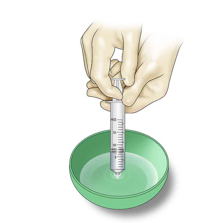 Marrow Cellution™ Component Flushing (Rinsing) - Aspire Medical Innovation